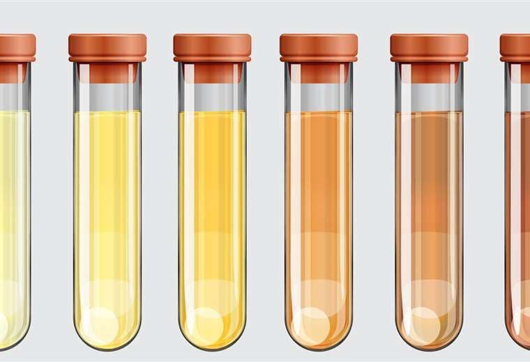Qué significa el color de tu orina y cuándo debes preocuparte | Teletica